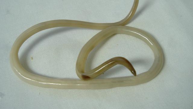 6 Obat Cacing Dewasa yang Ampuh, Lengkap dengan Harganya!