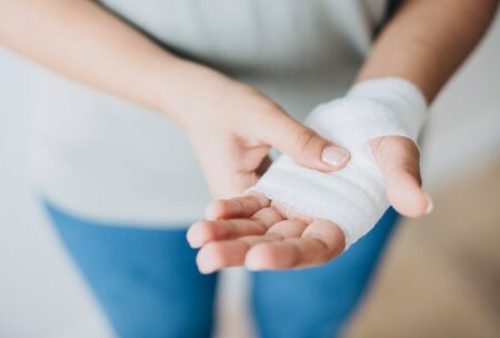 Cara Tepat Mengobati Luka Bakar Setiap Derajat Tingkat Keparahannya